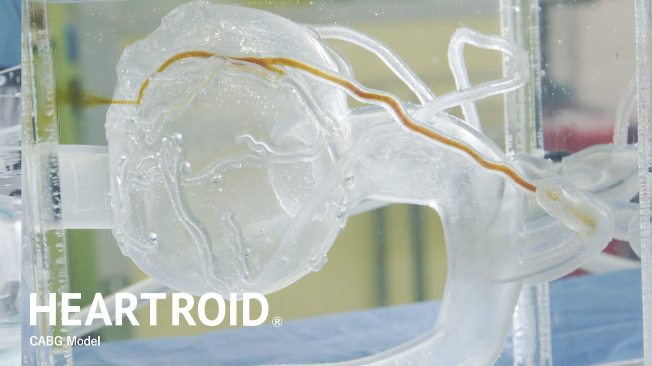 CABG Model | HEARTROID