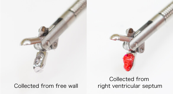 EMB Model | HEARTROID