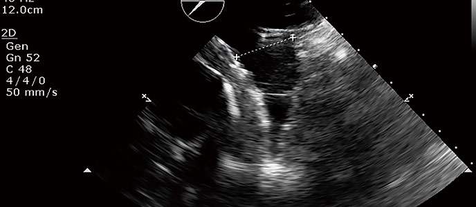 HEARTROID | MEDICAL TRAINING SYSTEM